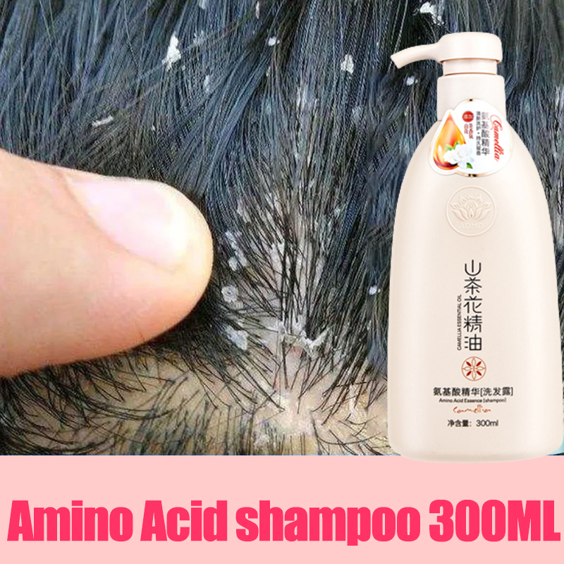 300ML Amino Acid Anti Dandruff Shampoo Anti Itching Anti Fungal Oil Control Refreshing Hair ...