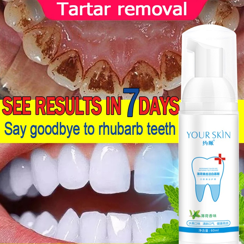 YANJIAYI 60ML Teeth Whitening Mousse Toothpaste for Oral Health Stains ...