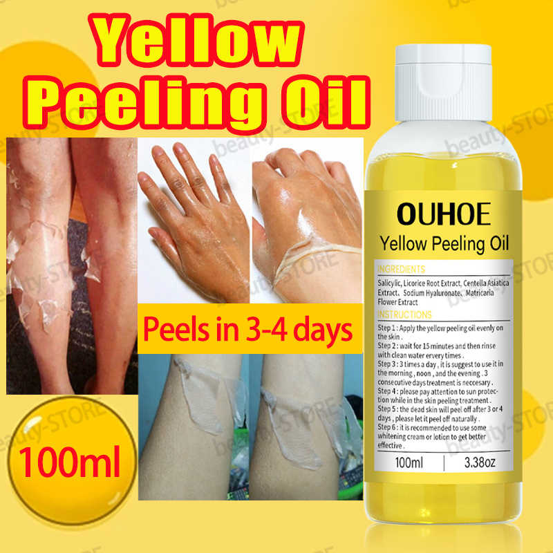 Yellow Peeling Oil Skin Peeling Body Underarm Peeling Lotion Clarity ...