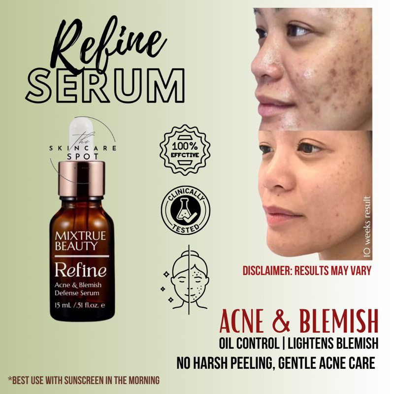 MIXTRUE BEAUTY Refine ACNE and BLEMISH Serum 15ml | Shopee Philippines