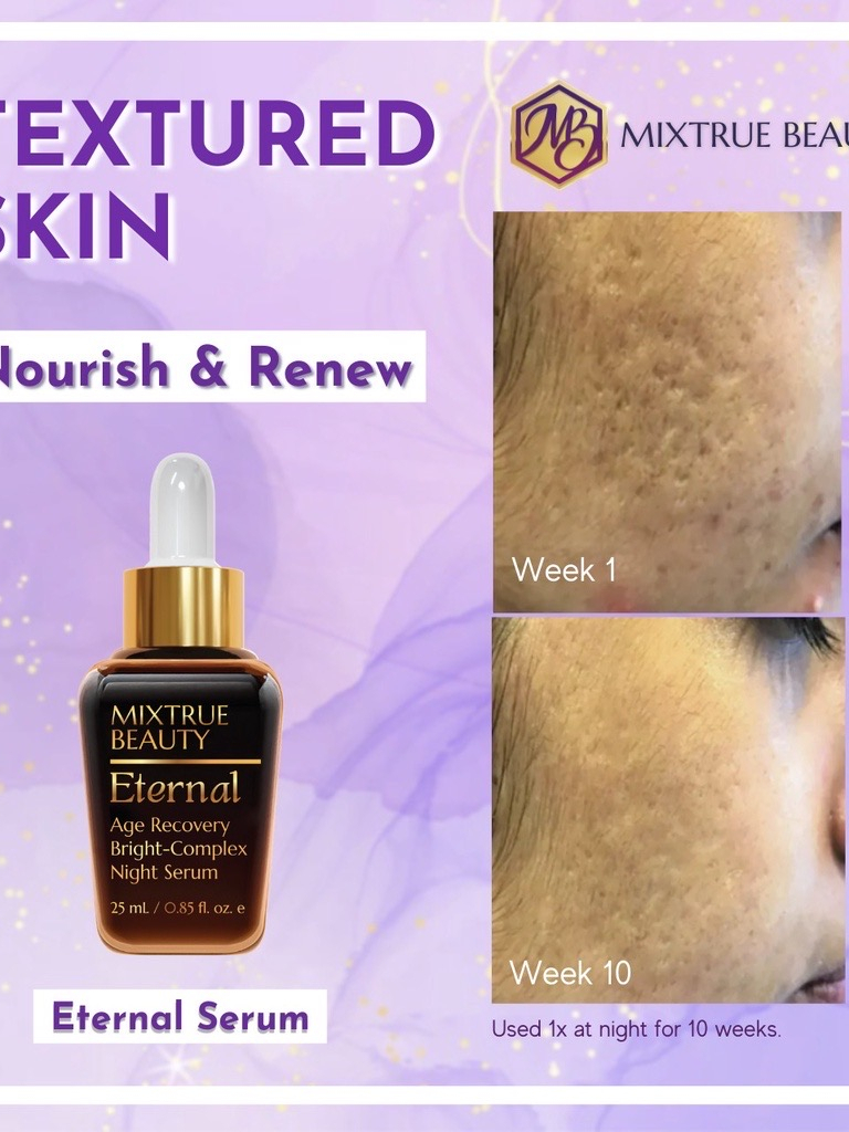 Anti-Wrinkle Melasma Set Eternal Serum Mini Age Recovery Bright-Complex ...