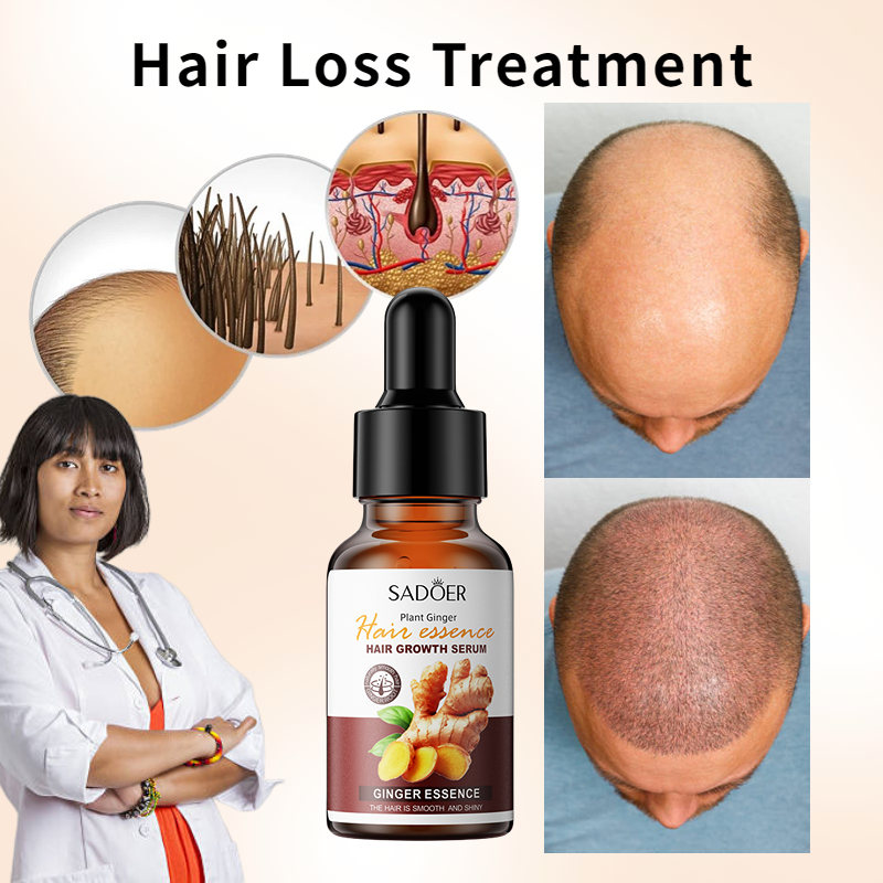Ginger Hair Grower Oil Hair Growth Serum Spray Pomade Anti Hair Loss ...