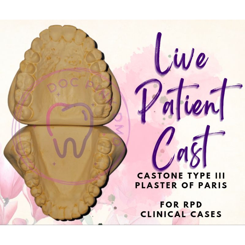 RPD Live Patient Cast for Dental School Laboratory/Clinical, and Dental ...