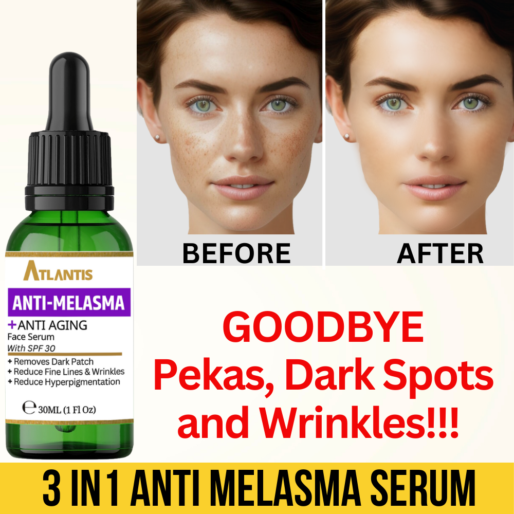 ATLANTIS 30ML 3-in-1 Anti-Melasma Serum + Anti Pekas + Anti Dark Spot ...