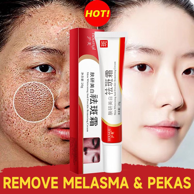 Melasma Cream Pekas Remover Original Collagen Pekas & Freckles Remover ...