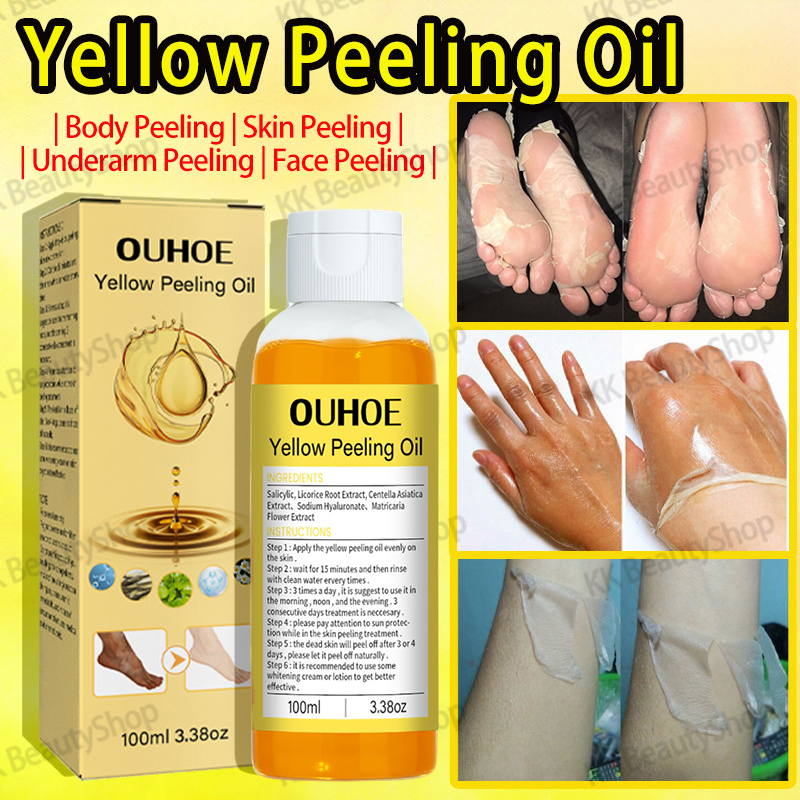 100ML Yellow Peeling Oil Original Face Foot Skin Peeling Underarm ...