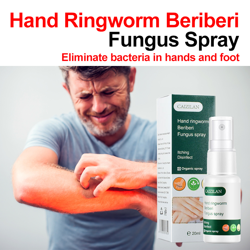 Anti Perspirant Itch Relief Organic Spray for Hand & Foot Ringworm Foot ...