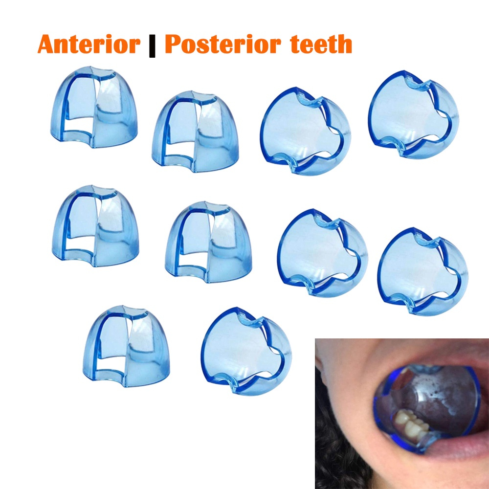 Mouth Opener Braces Lip Cheek Retractor Expander Oral Teeth Retract ...