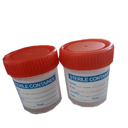 SPECIMEN CUP LABORATORY USE | Shopee Philippines