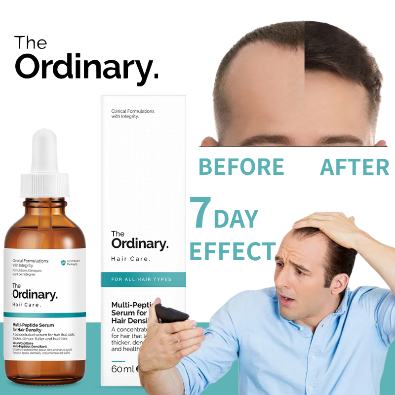 The Ordinary Multi Peptide Hair Serum Novu Hair Grower Hair Growth Hair ...