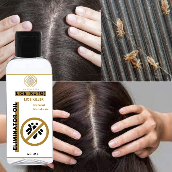 MWG- Lice (Kuto) Eliminator Oil, Lice Killer Oil Kuto & Eliminator Oil ...