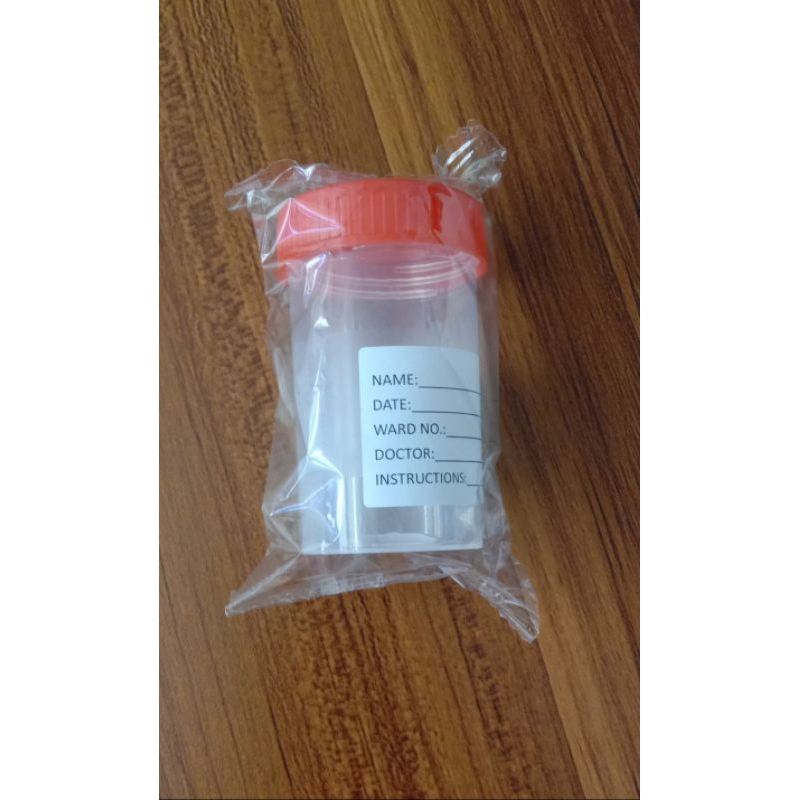 Urine and stool Container (Sterile and Non-sterile) | Shopee Philippines