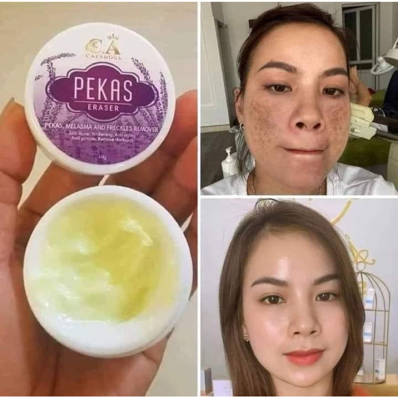Pekas Skin Lightening CREAM (New Packaging with freebies ) | Shopee ...