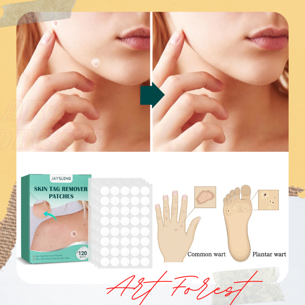 Skin Tag Remover Patch Wart Treatment Stickers Absorb Plaster ...