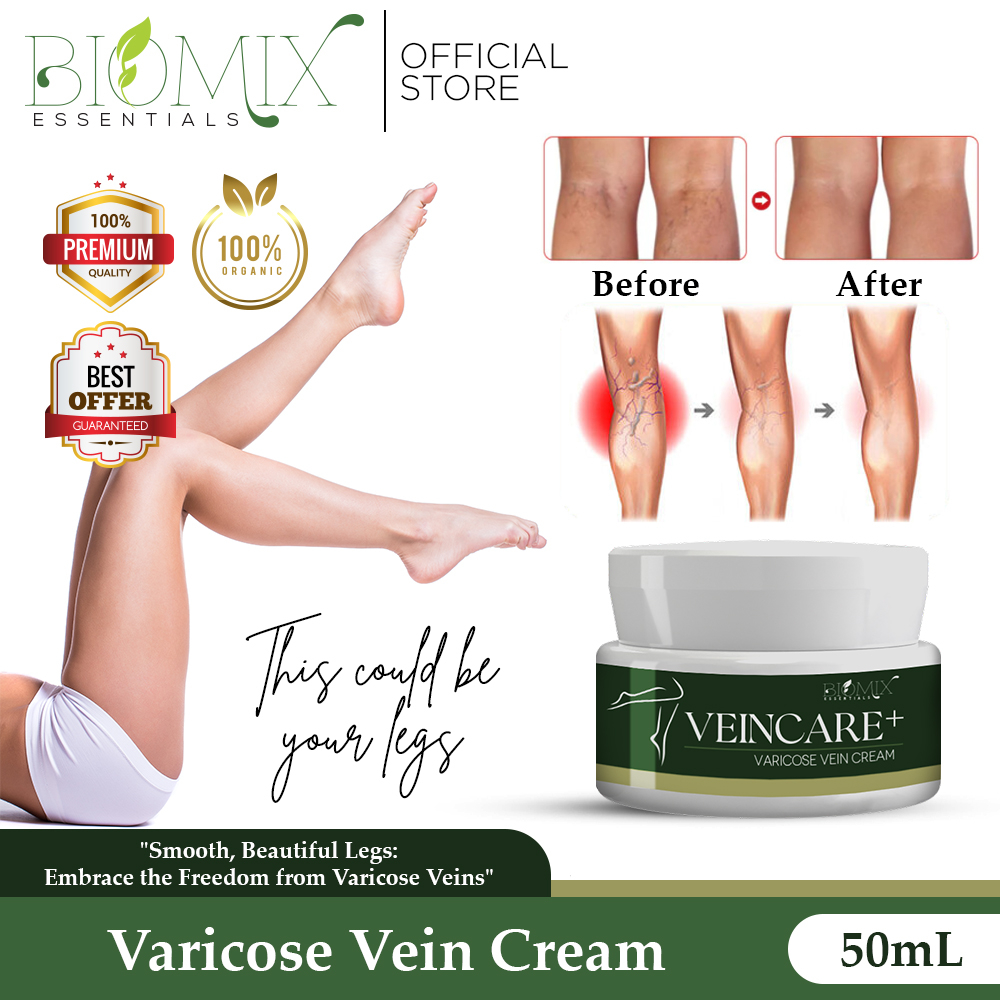 Biomix Varicose Vein Remover Cream Varicose Veins Effective Remover ...