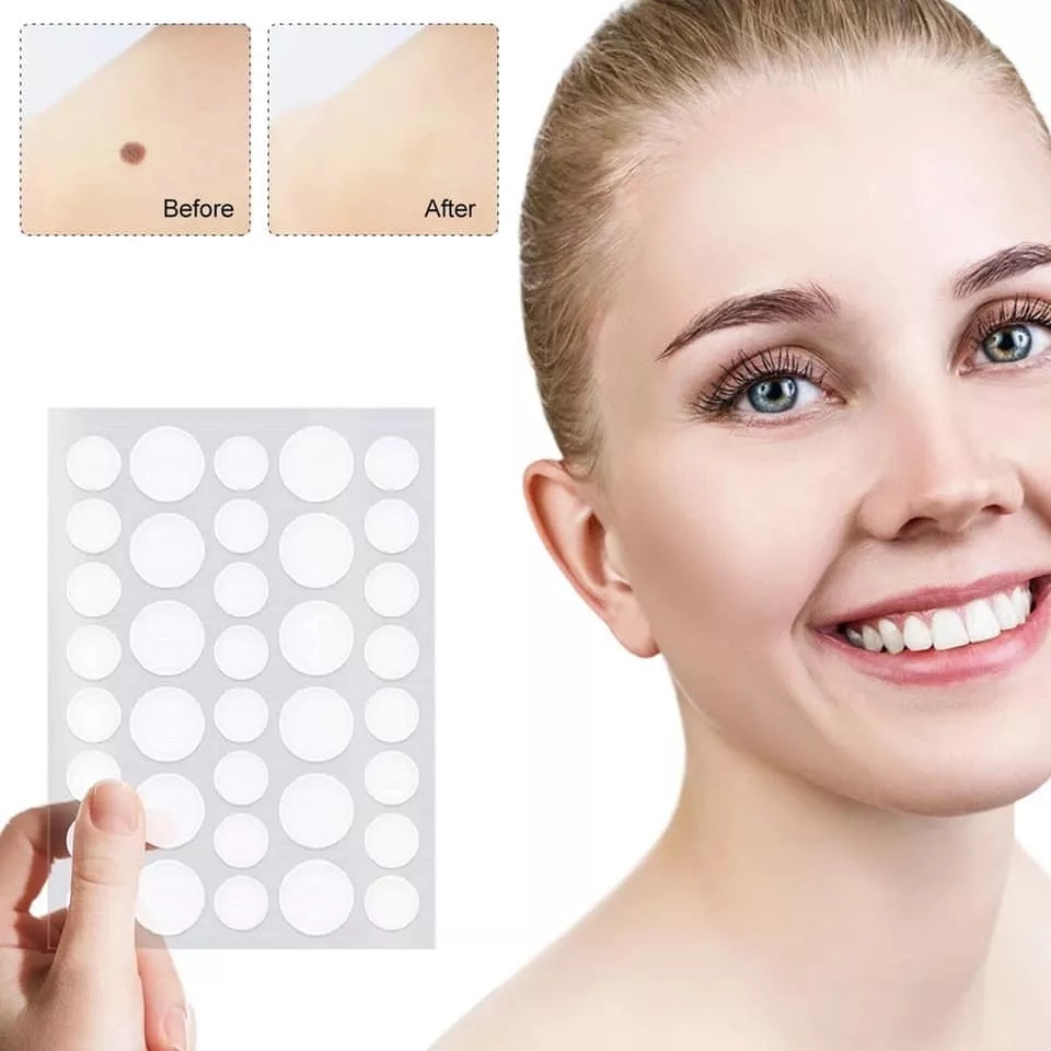 36pcs Acne Pimple Patch Invisible Acne Stickes Remover Beauty Tool Skin ...