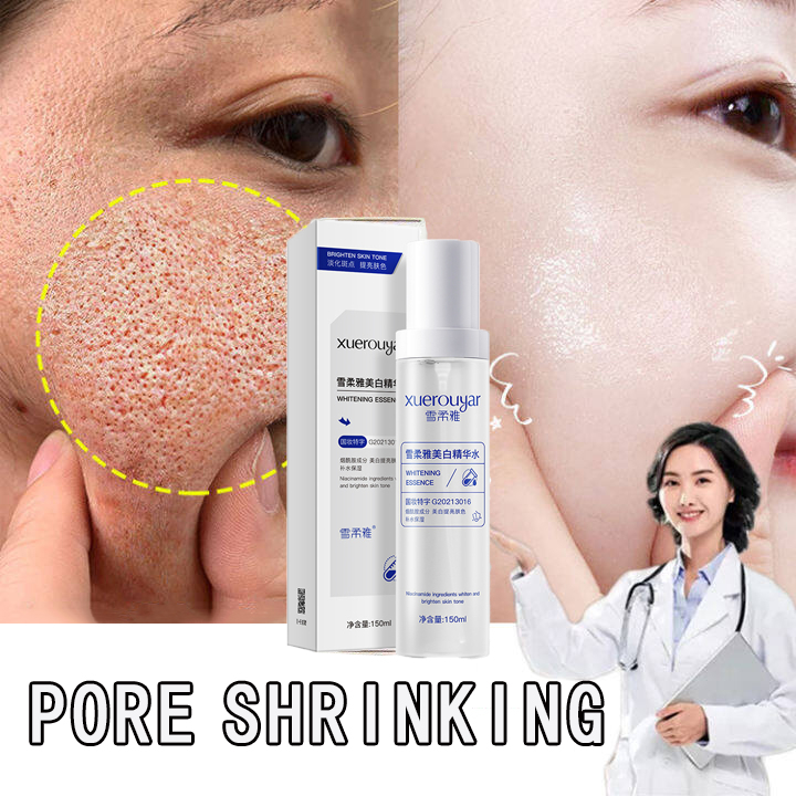 Whitening Toner For Face Acne And Pimple Marks Removal Shrink pores ...