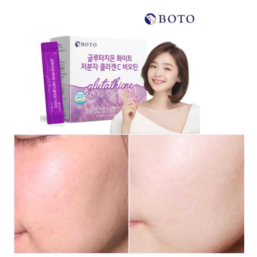BOTO Glutathione White Low molecular Collagen C Biotin (30 Sticks ...