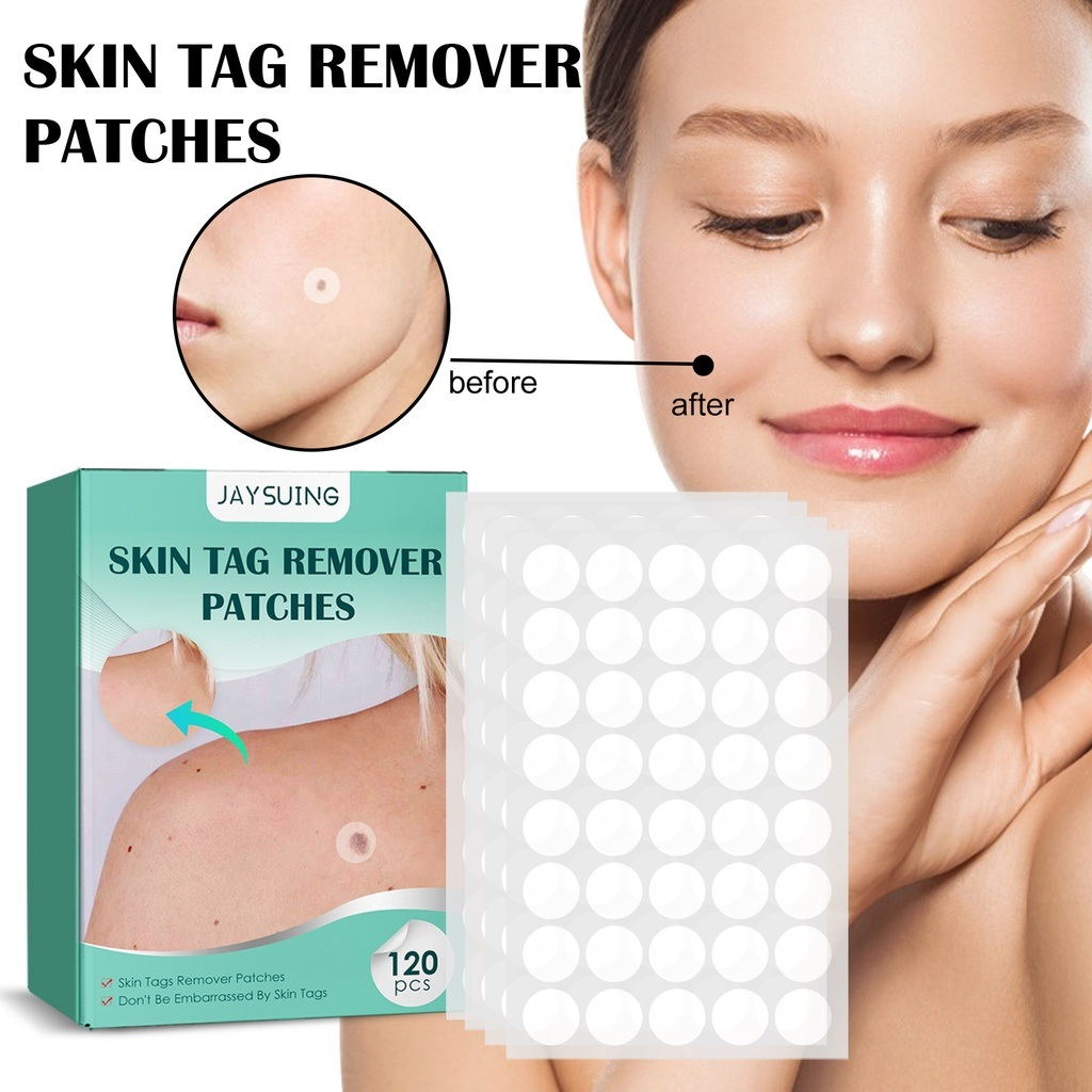 Skin Tag Remove Wart Treatment Sticker Body Pimple Acne Remover 120 Pcs ...