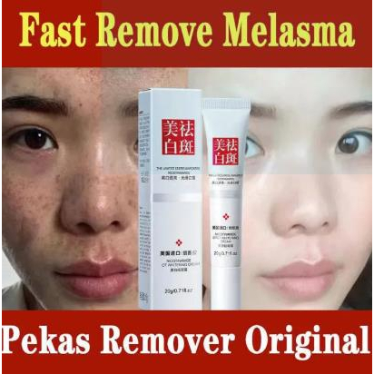 Anti Melasma Removal and Dark Spots Cream Effective Acne Scars ...
