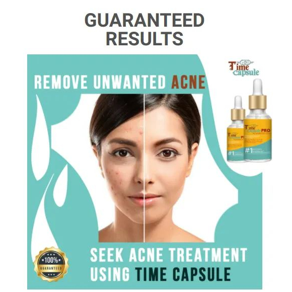 BELO TIME CAPSULE Treatment for Acne Care Anti Aging Moisturizing ...