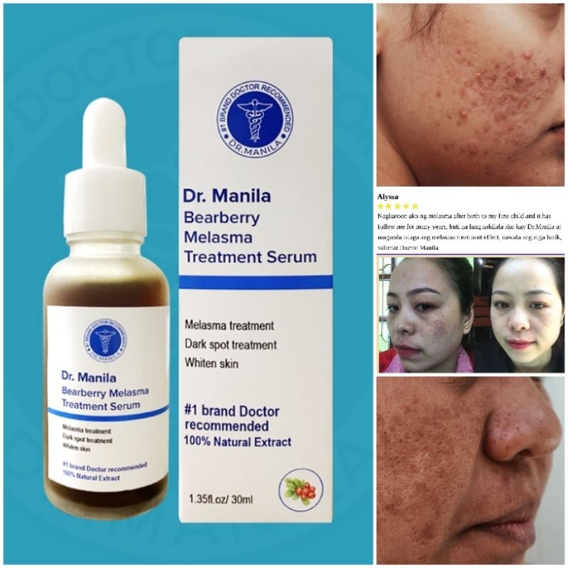 Dr. Manila Melasma Treatment Bearberry serum (Authentic) | Shopee ...