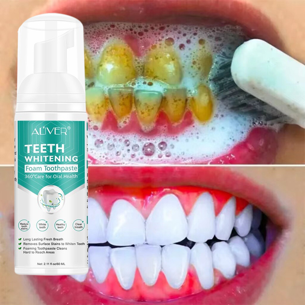 ALIVER Teeth Whitening Mousse Toothpaste Remove Plaque Oral Odor ...