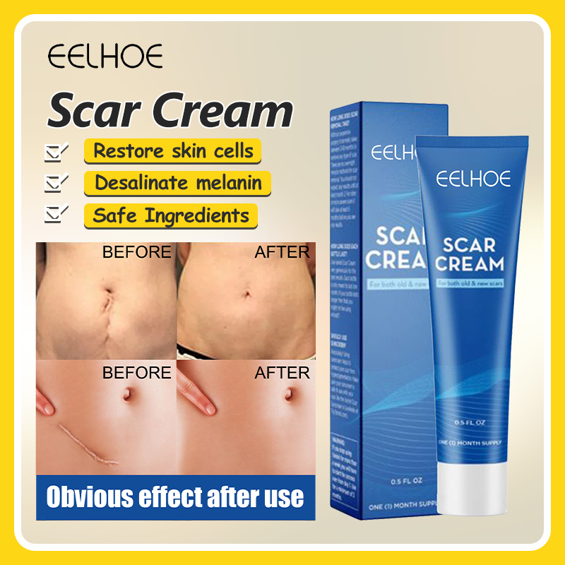 Scar Remover Original Scar Cream Fade Marks Lighten Scar & Smooth Skin ...