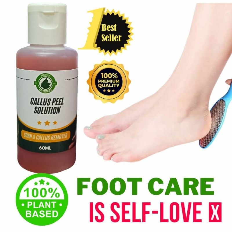 Callus Set Remover/Callus Peel Remover/Pantanggal Kalyo/Callus Peel Solution | Shopee Philippines