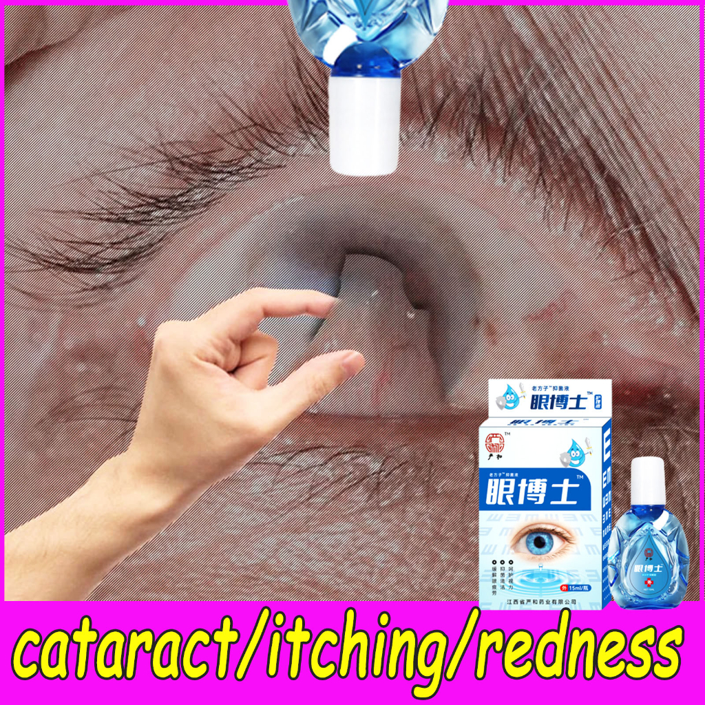 30ml visine/cmd/rohtoz/bioline eye drops contact lens eye care for dye ...