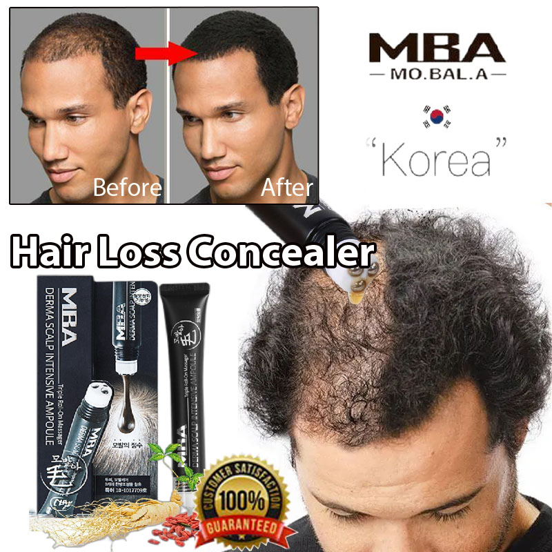 Korea mba Hair Growth Serum Fast Hair Growth Spray Hair & Scalp ...