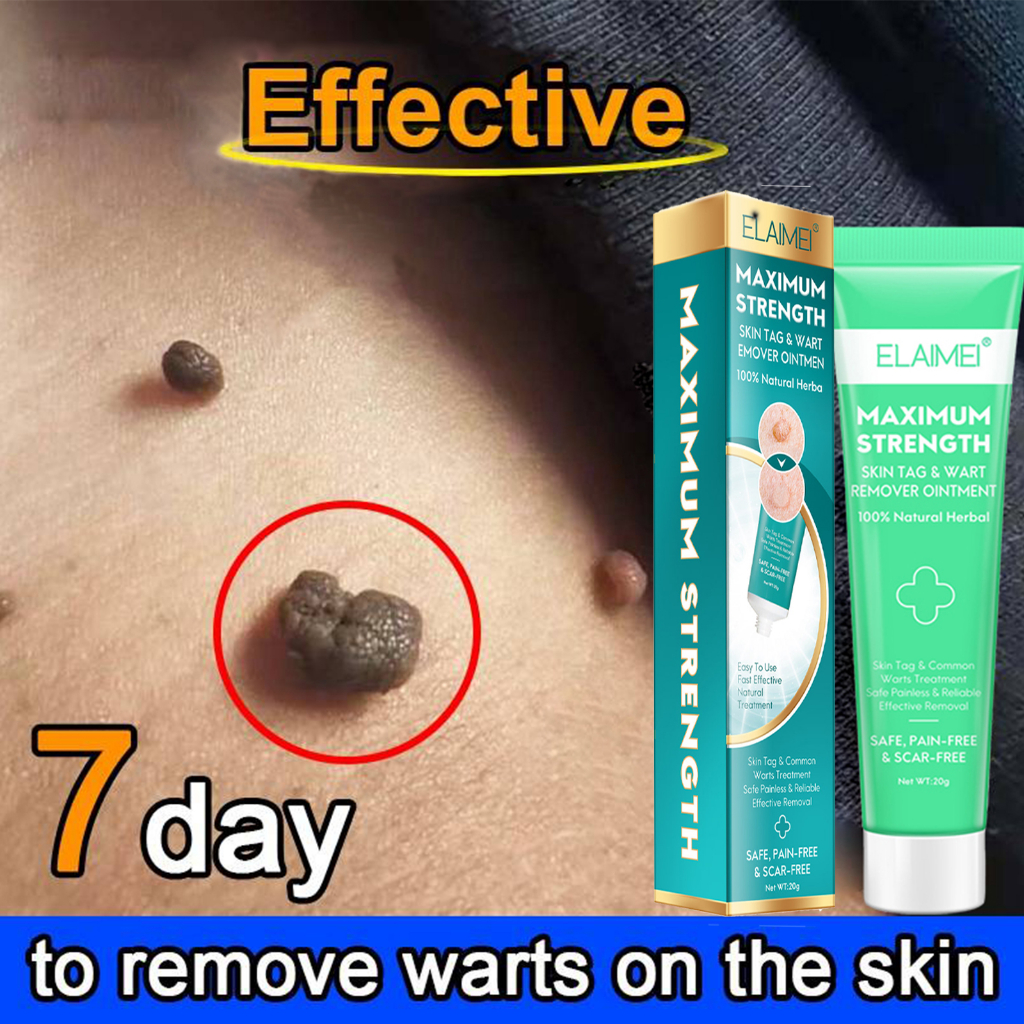 Warts Remover Original Cream Effective Painless Wart Removal Ointment ...