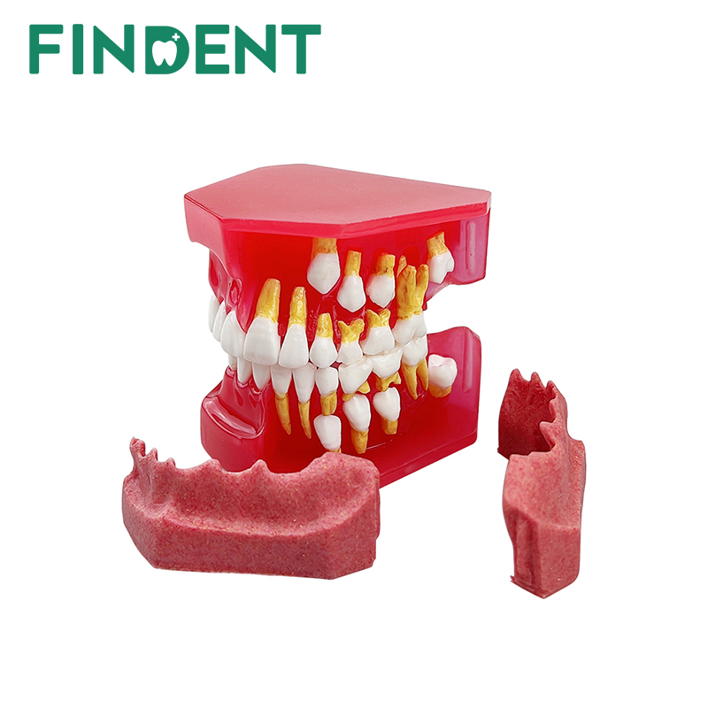 Teeth Eruption Development Model Alternating Model of Constant Pressure ...