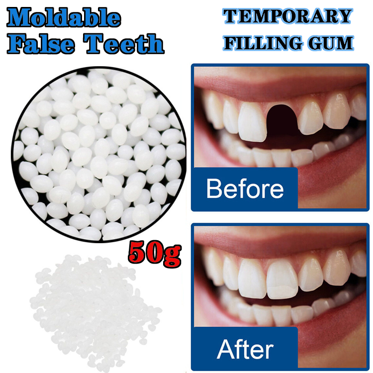 50G Temporary Tooth Repair Kit for Fix Filling The Missing Broken Tooth ...