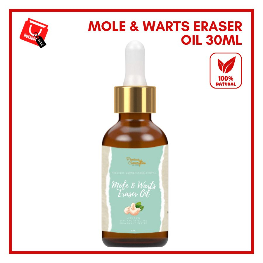 Mole and Warts Eraser Oil 30ml Quickly and Easily Remove Common Skin ...