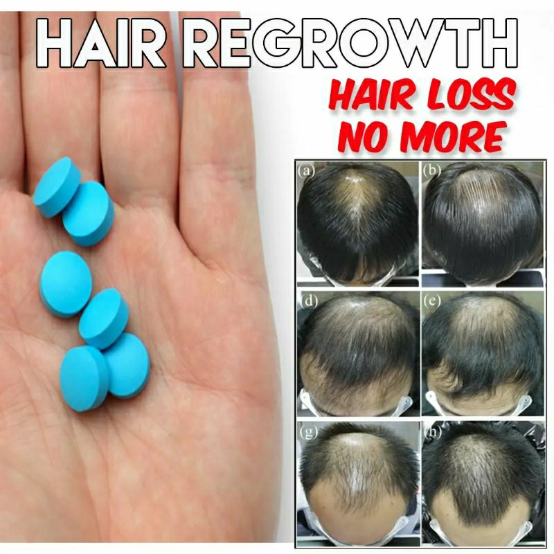 Gosterid | Saphteride | Hair Regrowth Tablet | Hair Loss Solution | FDA ...