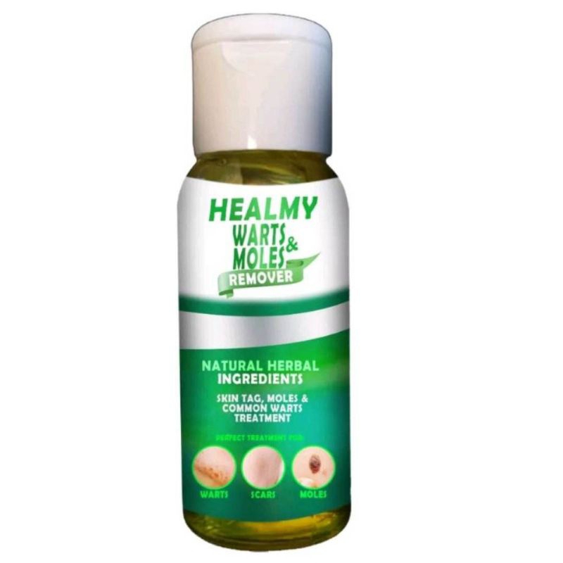 HEAL MY WARTS REMOVER MOLE REMOVER GOODBYE NUNAL | Shopee Philippines