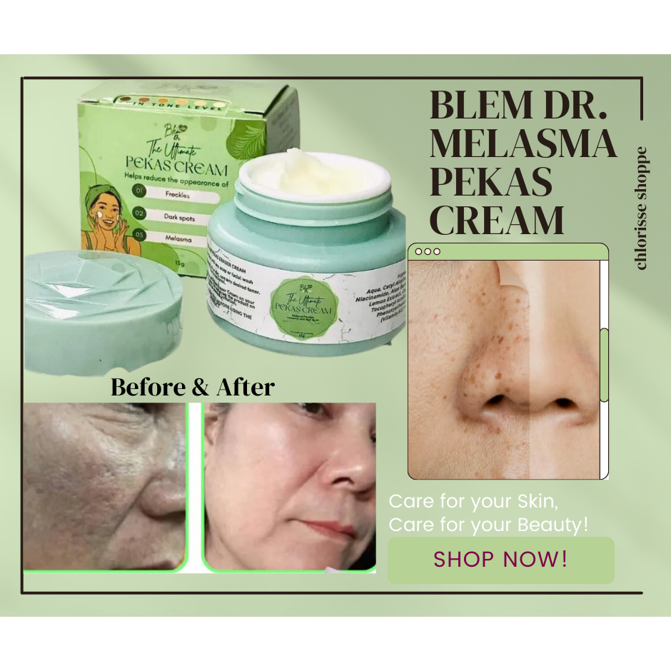 Blem Dr Pekas Cream Your Ultimate Melasma, Pekas, and Darkspots Cream ...