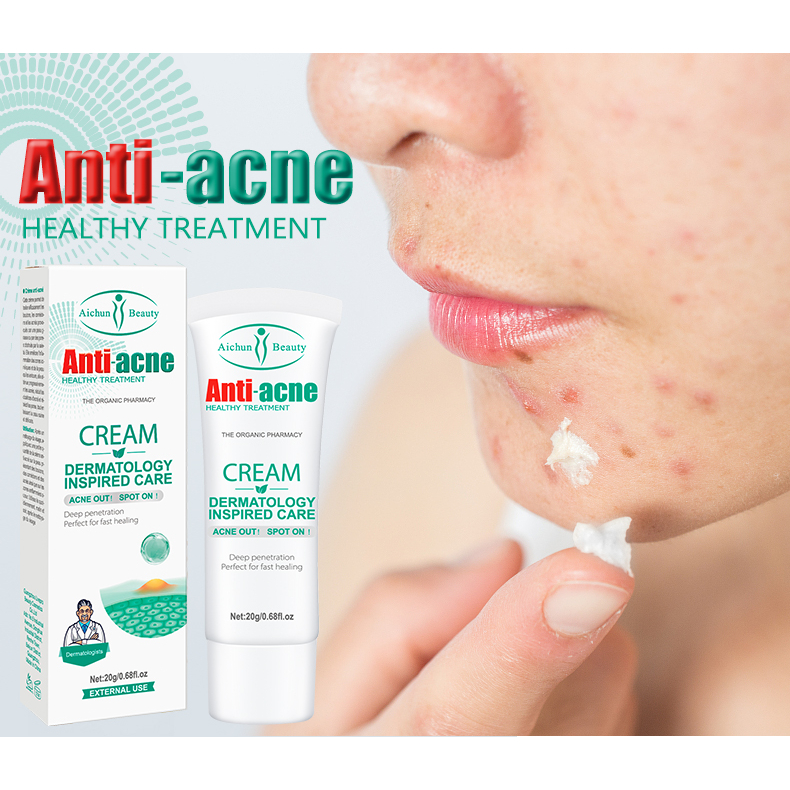 Acne Remover Cream 20g Repair Face Skin Acne Pimple Treatment Scar ...