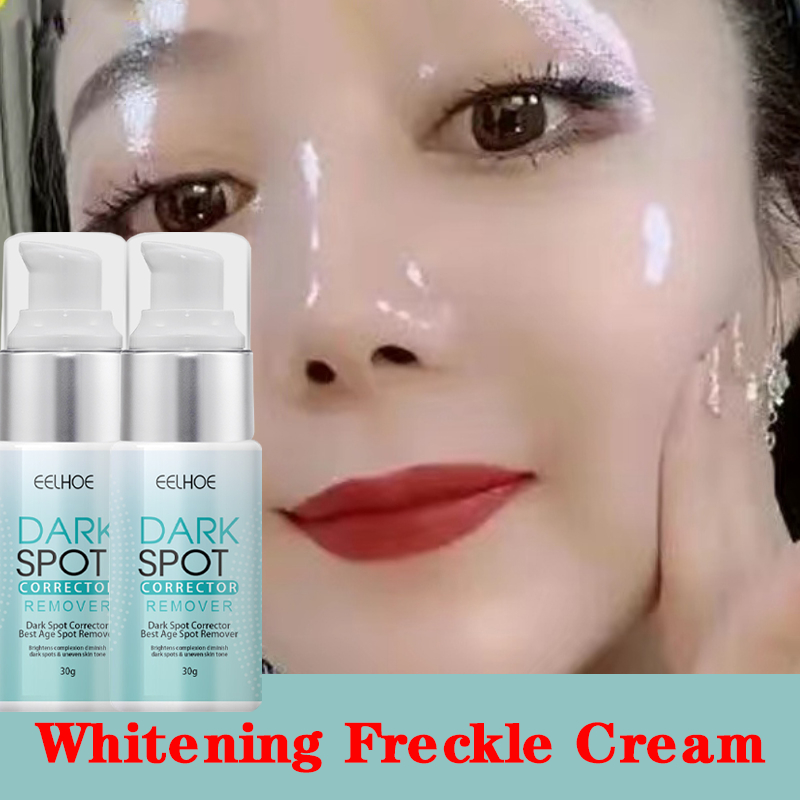 Melasma Cream Pekas Dark Spot Remover Original Collagen Pekas ...