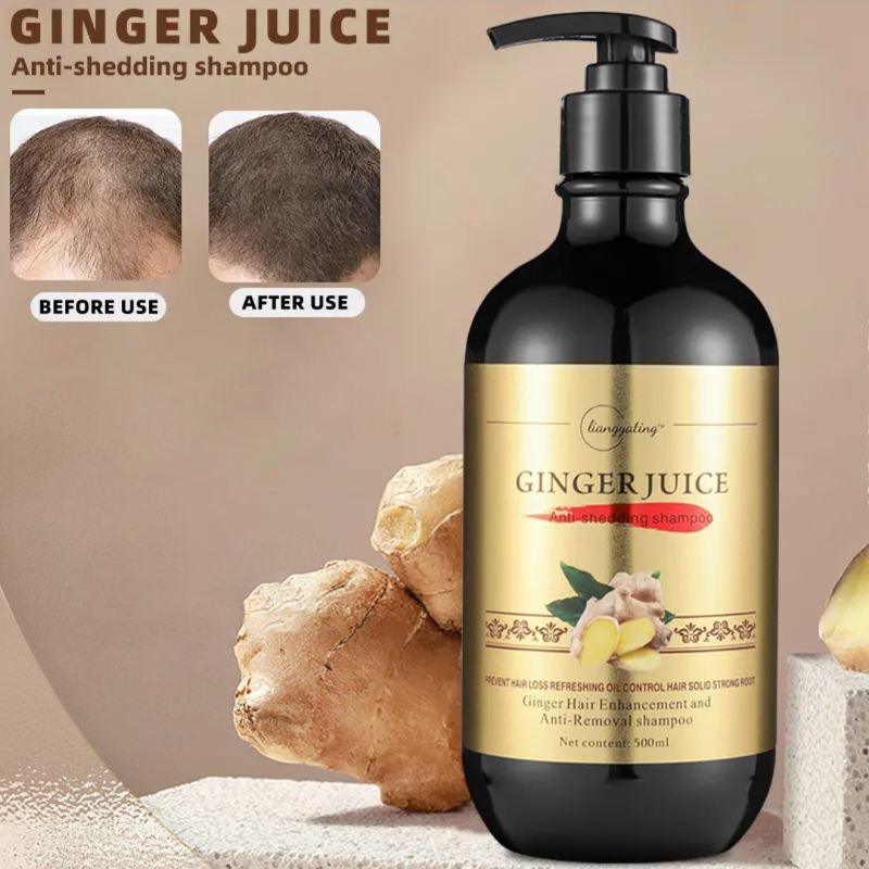 Organic Ginger Shampoo Ginger Hair Growth Set 500ml – Anti-Hair Loss ...