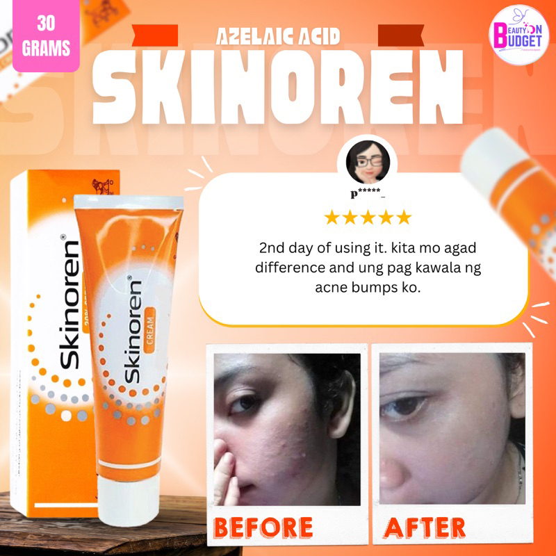 Authentic Skin-orem Cream 20% Topical treatment of acne vulgaris 30g ...