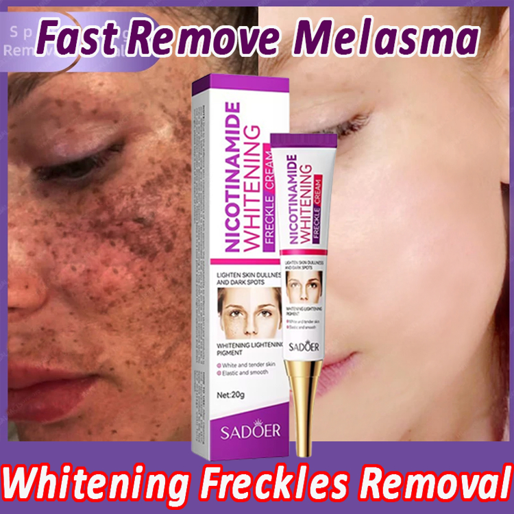 Melasma Cream Pekas Remover Original Whitening Freckles Remover Cream ...