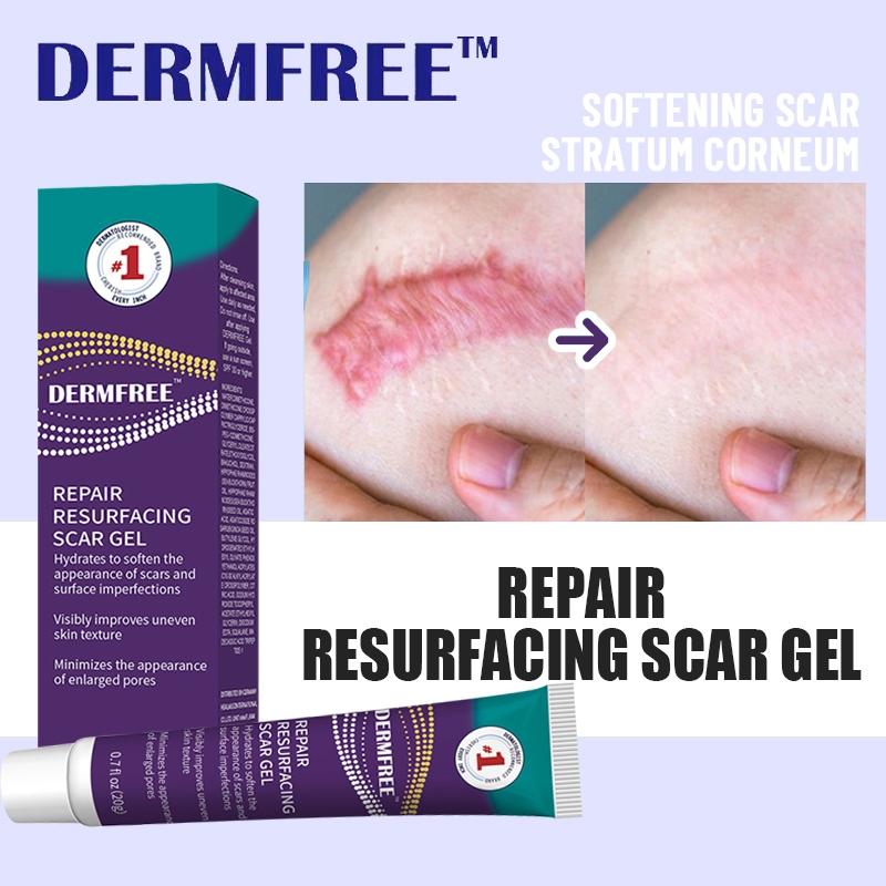 Old Scar Remover Cream | Scar Minimizer Cream | stretch mark Gel leg ...
