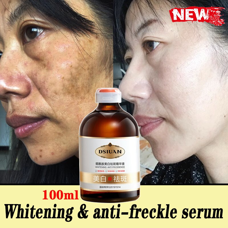 Serum For Dark Spots Anti Freckles Whitening Nicotinamide Essence ...