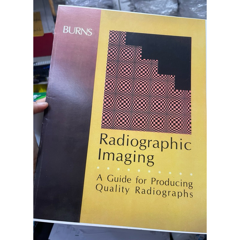 Radiographic Imaging Burns | Shopee Philippines