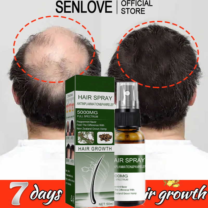 50ML Ginger Hair Grower spray Anti Hair Loss Hair Growth Treatment Hair ...
