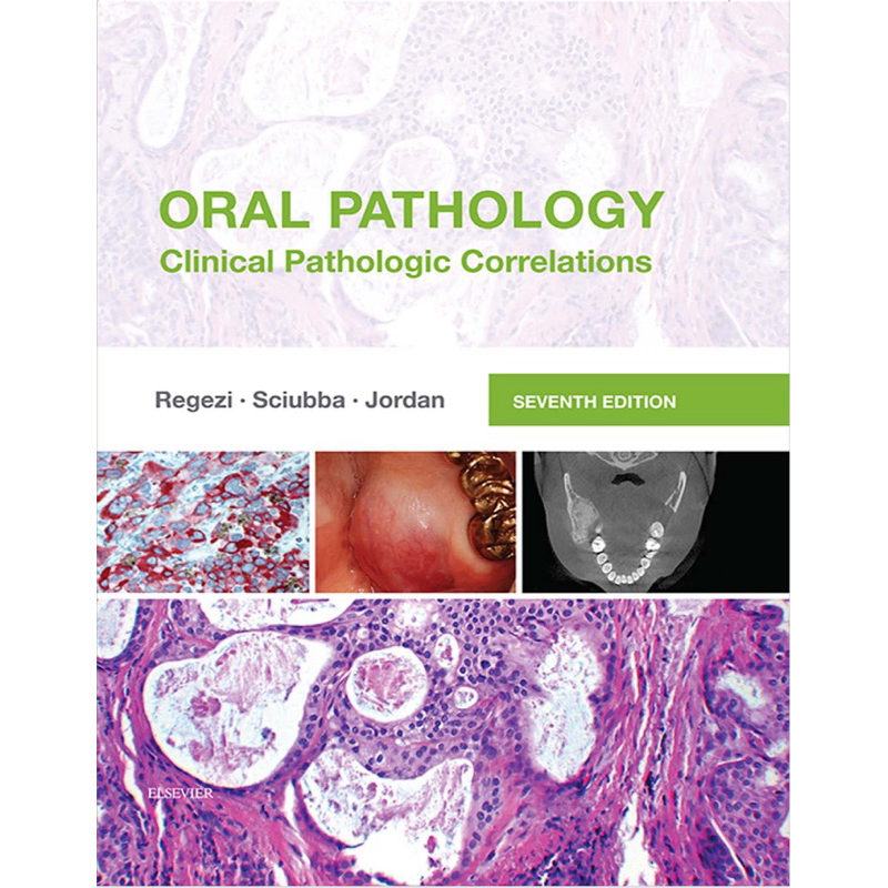 Oral Pathology: Clinical Pathologic Correlations 7th Edition | Shopee ...