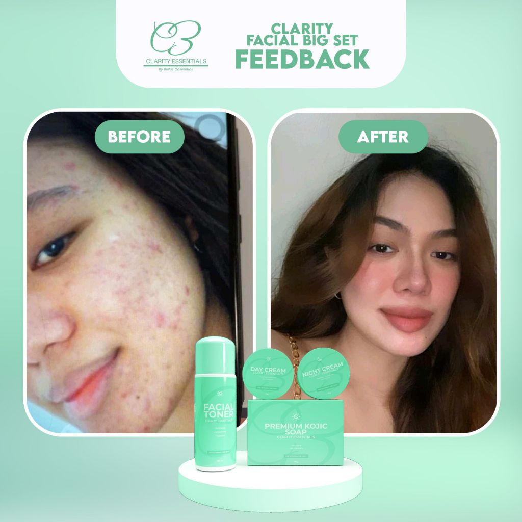 FDA Approved | Clarity Facial Set Glass Skin Effect | Clarity ...