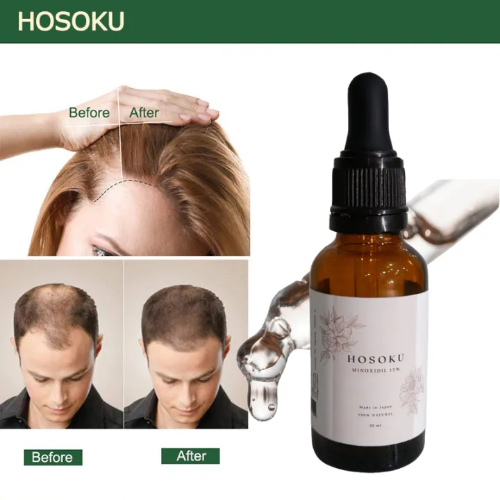 HOSOKU 15% minoxidil with collagen, castrol oil and essential oil 30mL ...